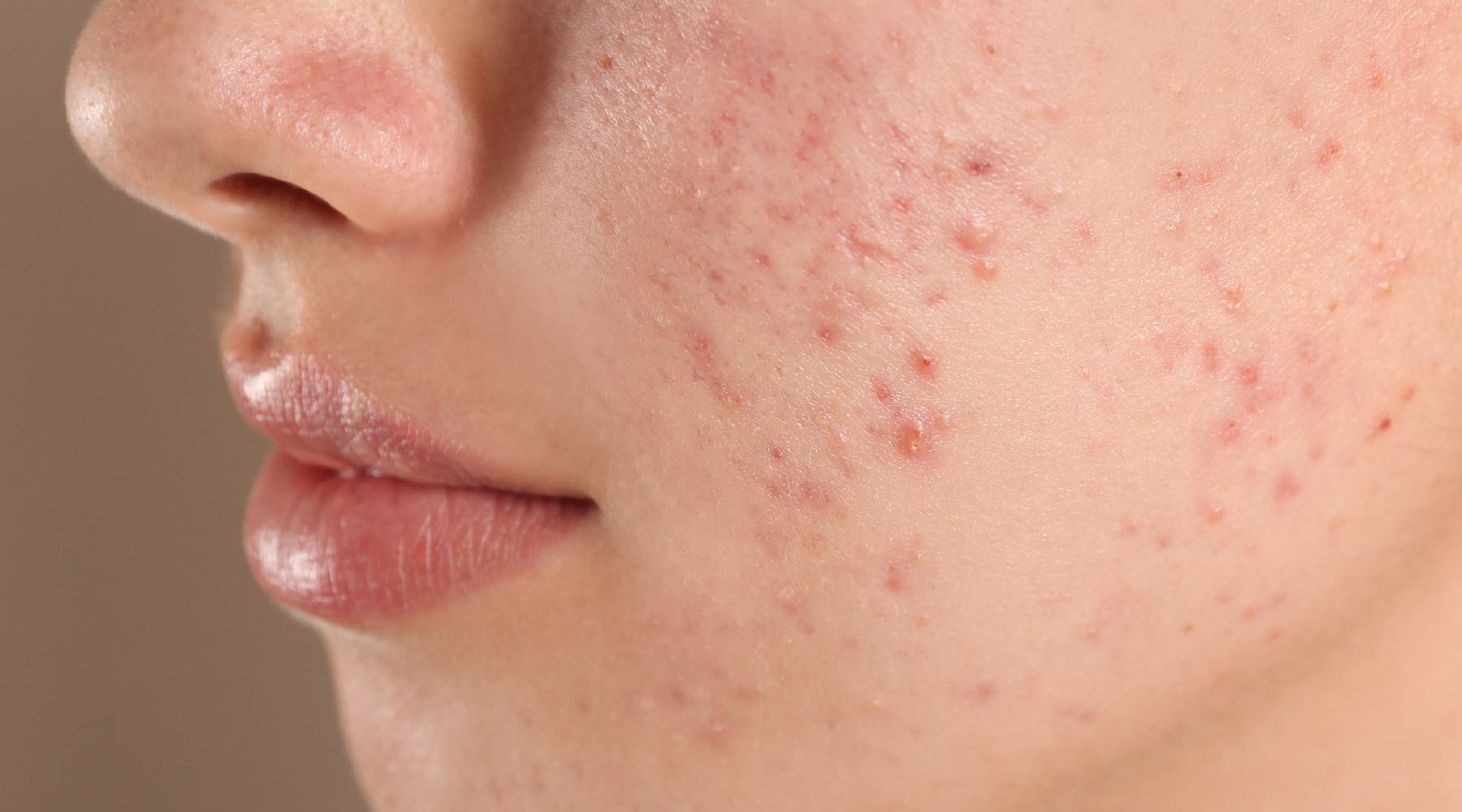 Estheva | Medical Aesthetic Clinic Stirling